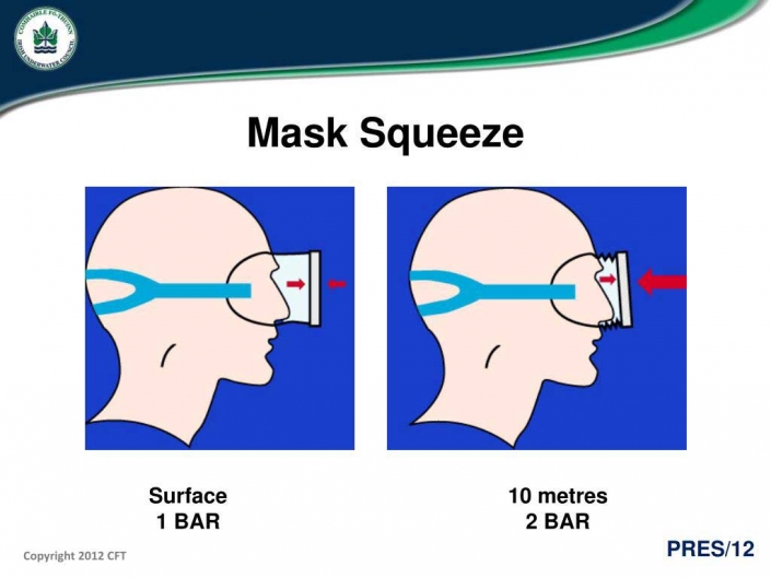 فشردگی ماسک غواصی - علل و خطرات - دریاکاو